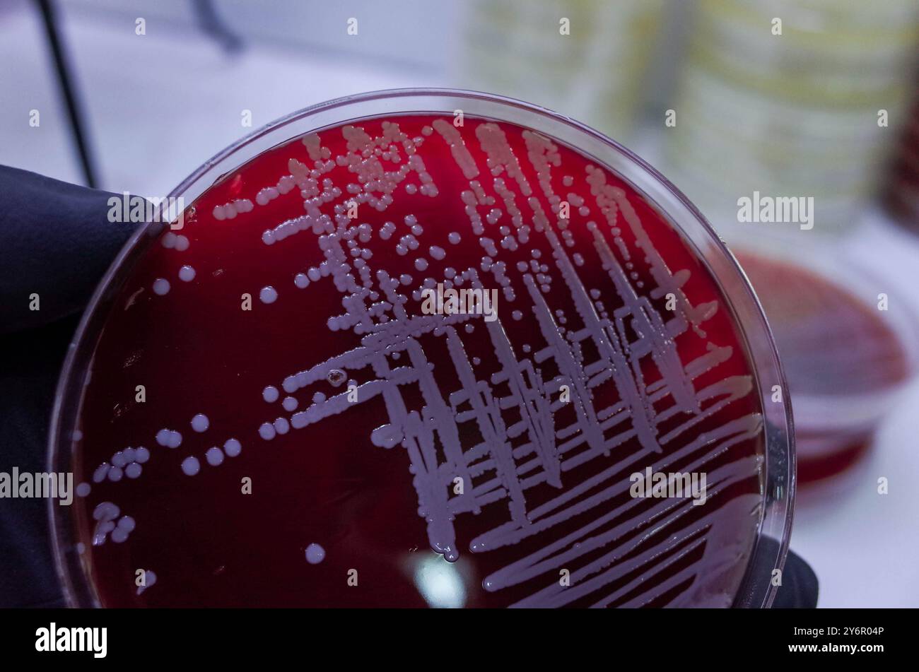 Bacteria growing in a petri dish hi-res stock photography and images ...