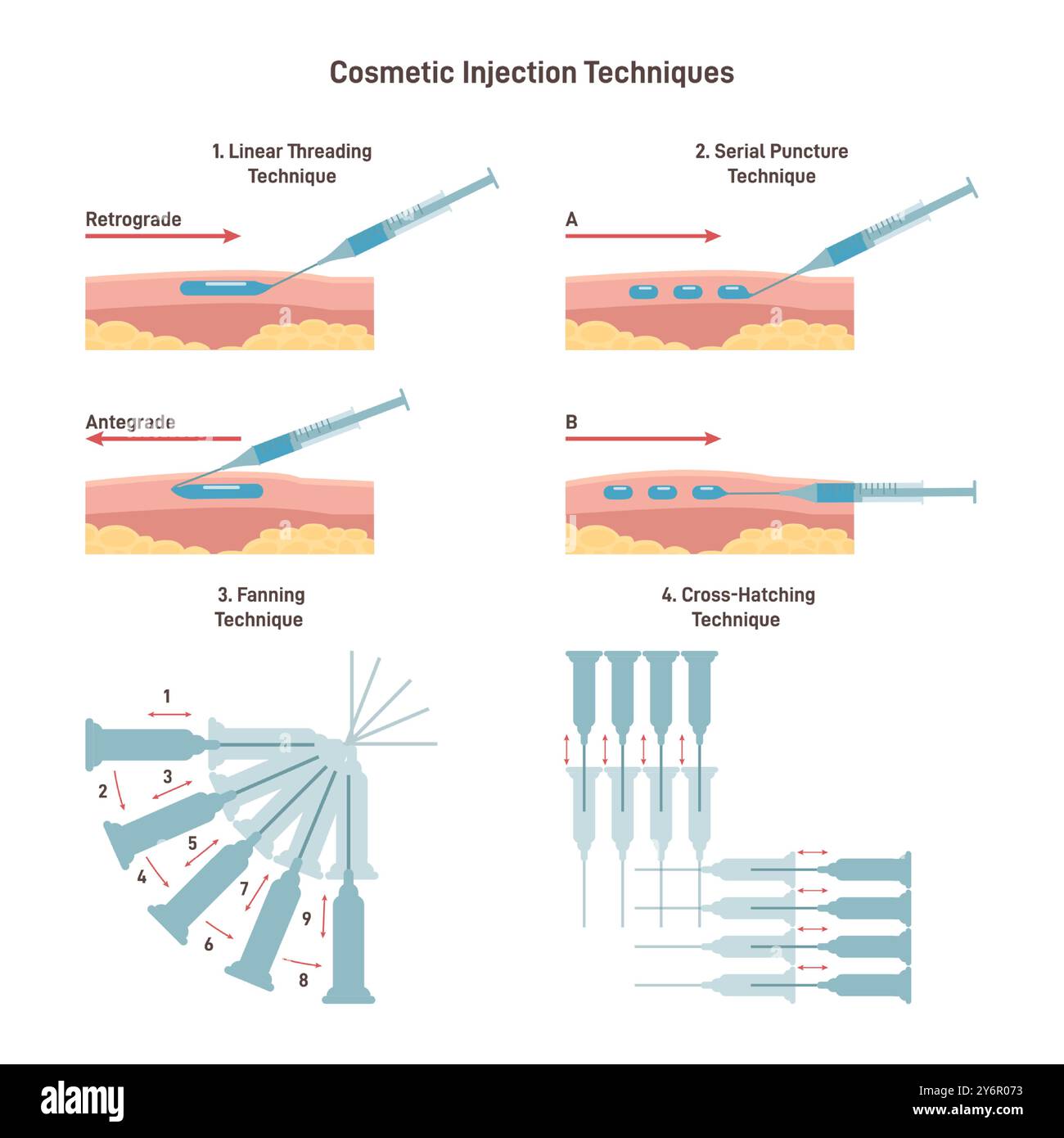 Cross hatching hi-res stock photography and images - Alamy