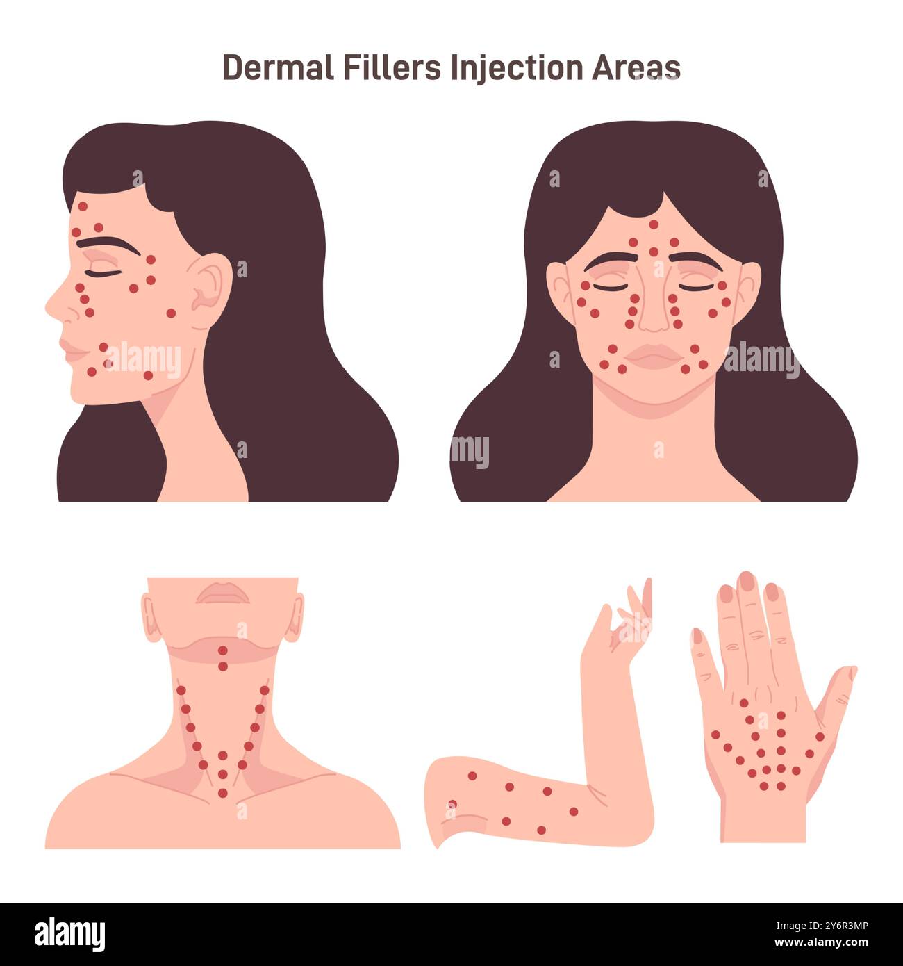 Dermal filler injections sites. Woman face, neck and hands with ...