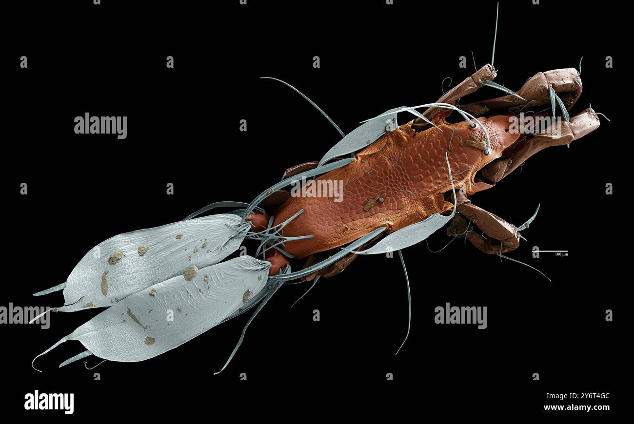 Feather Mite, SEM Stock Photo - Alamy