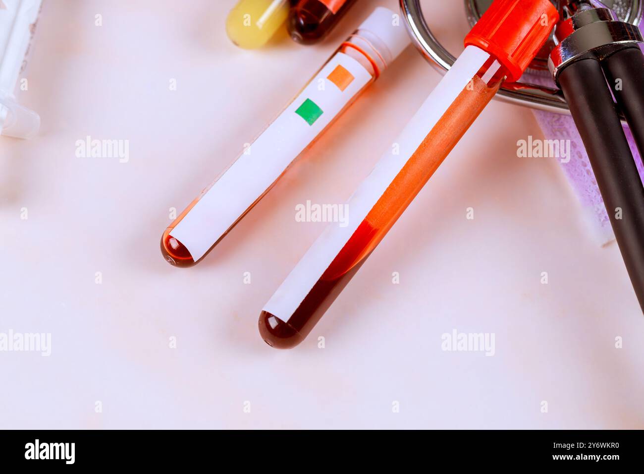 Medical tube containing blood sample for examination in laboratory ...