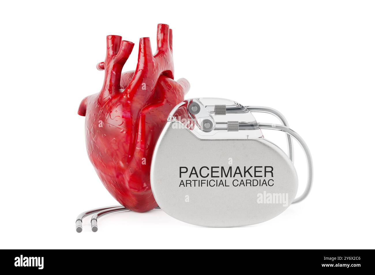 Implantable Artificial Cardiac Pacemaker Device with Red Human Heart on ...