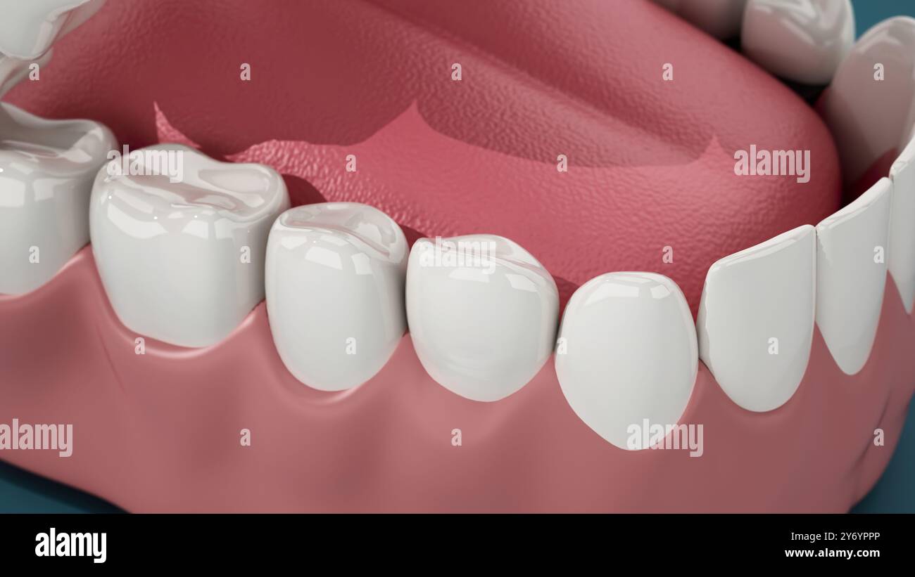 Detailed 3D illustration of a model jaw with complete set of teeth. 3D ...