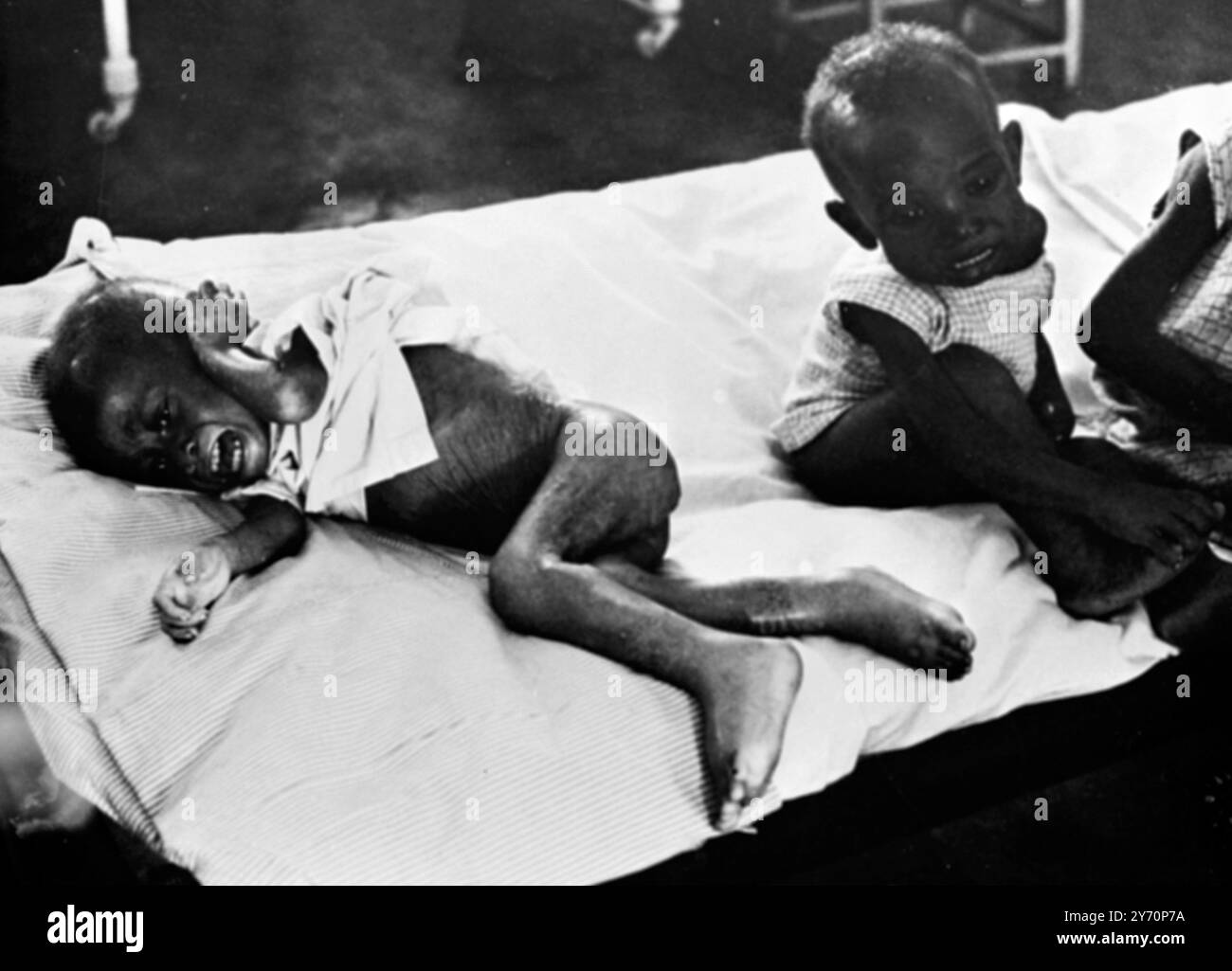 Two small children dying from starvation in a Nigerian refugee camp ...