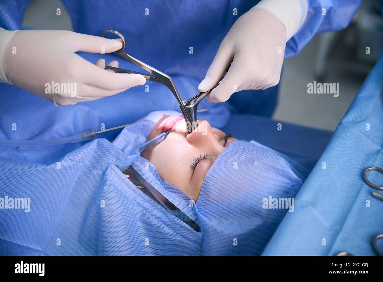 Maxillary sinusectomy hi-res stock photography and images - Alamy
