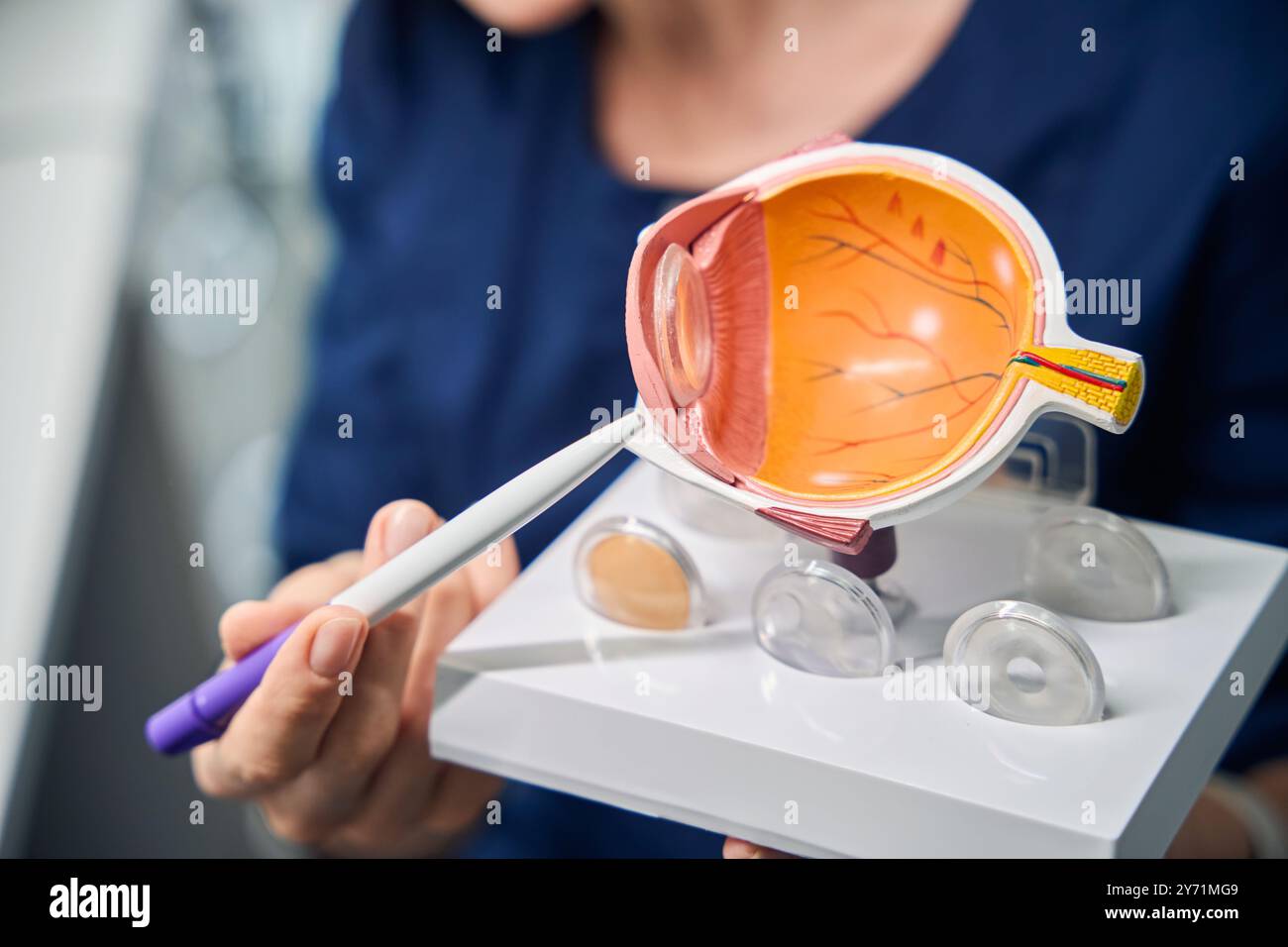 Eye model demonstration in female doctors hand Stock Photo - Alamy