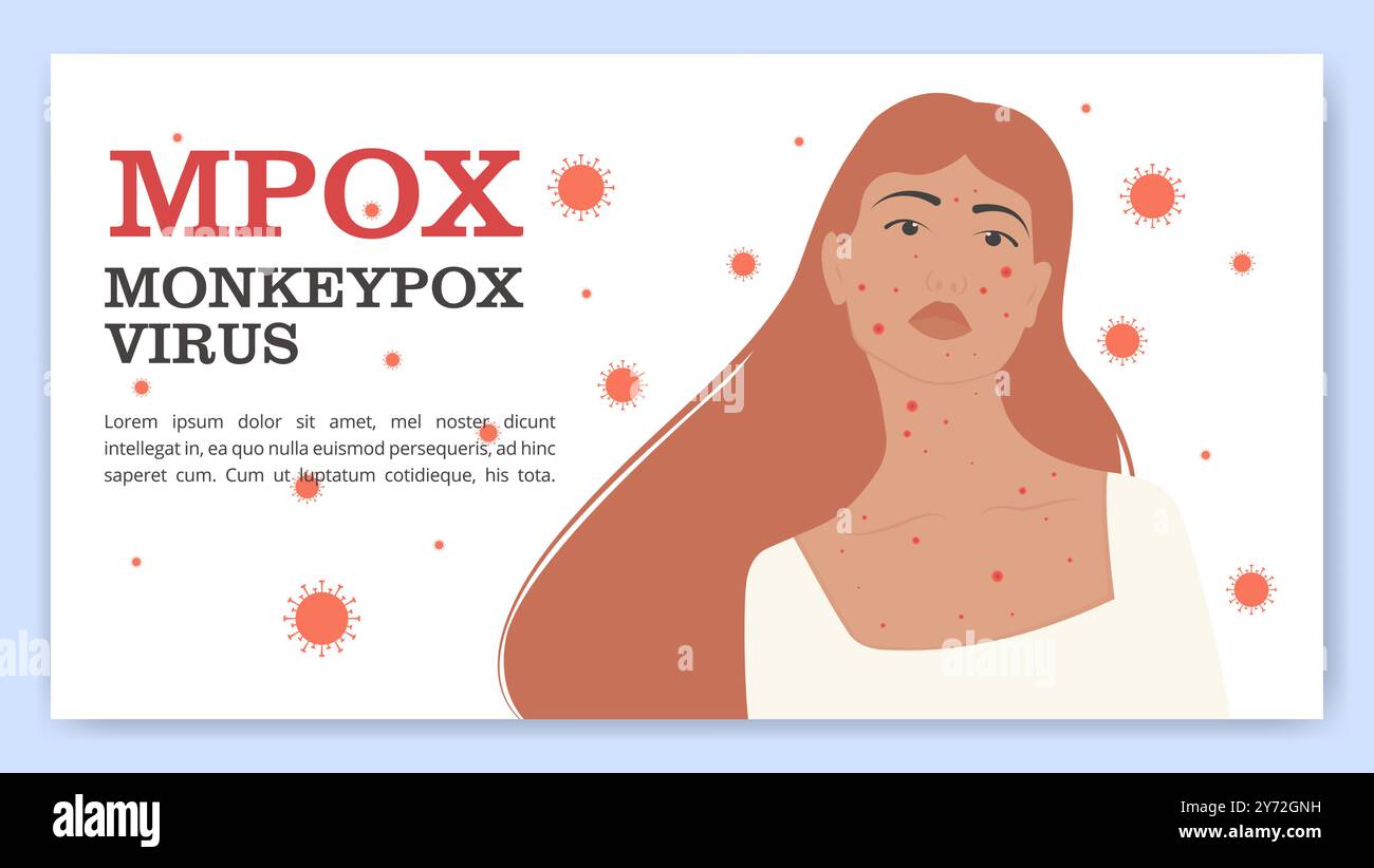 Danger of Mpox virus concept banner. Infected woman from monkey flat ...