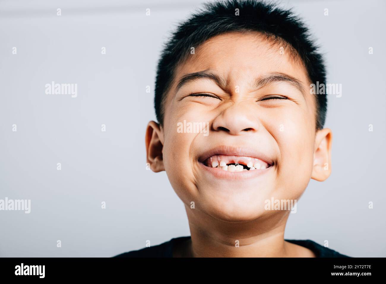 Smiling kid upper tooth lost gap shows. Child dental growth isolated on ...