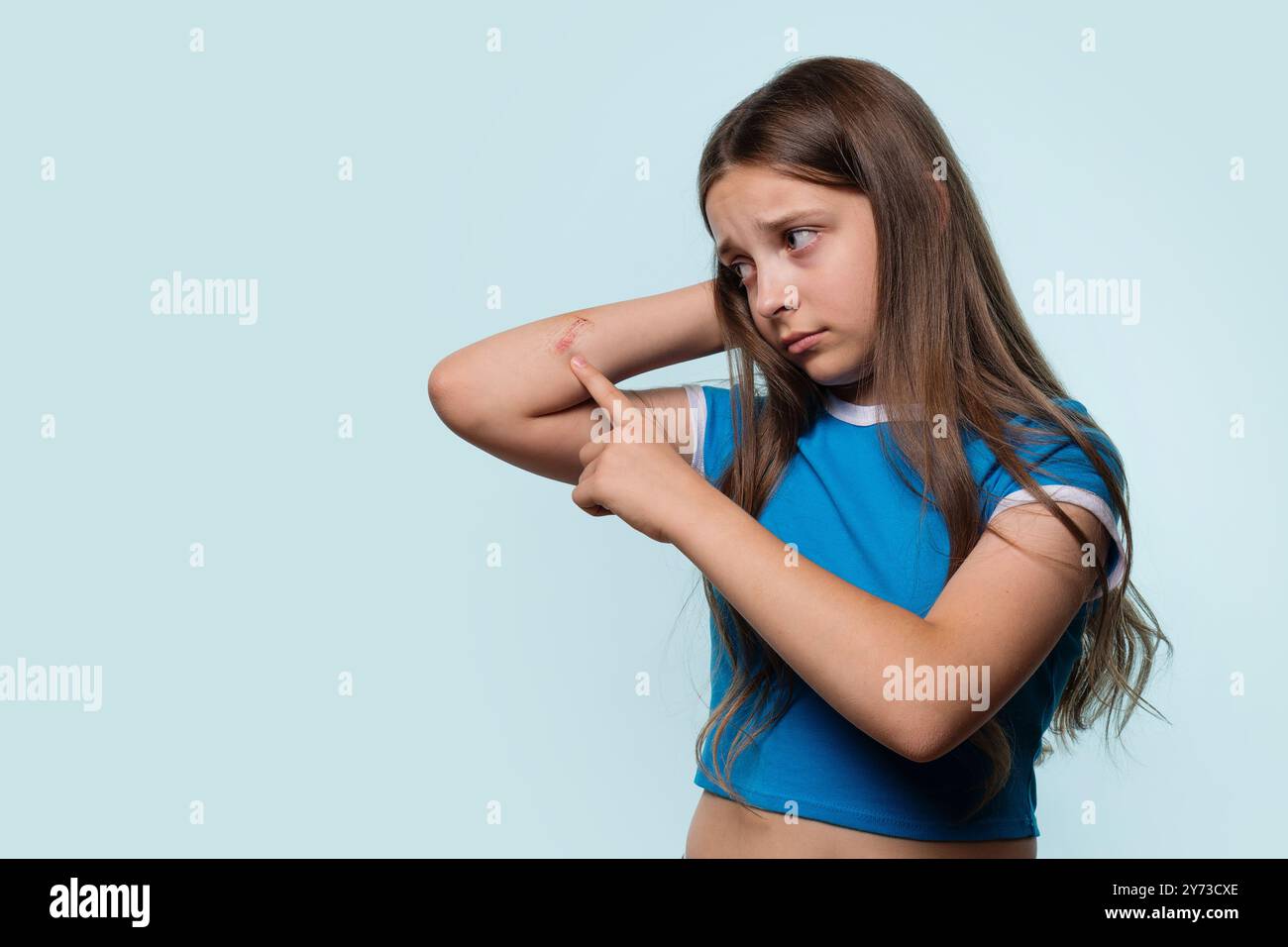 A young girl looking worried as she points to a cut on her elbow in a ...