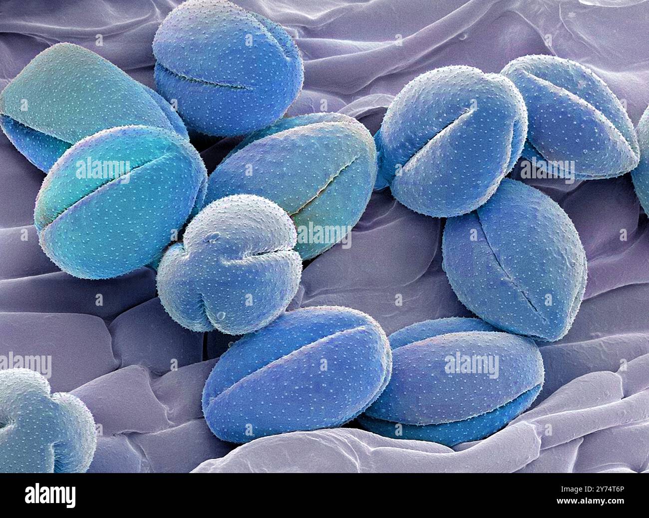 Pasque flower pollen, SEM Stock Photo - Alamy
