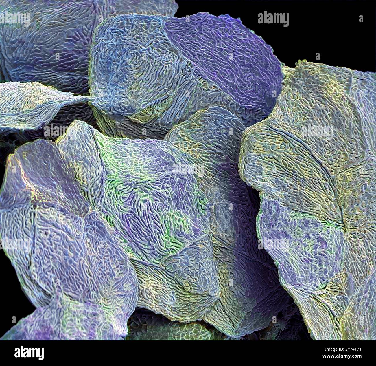 Skin cells. Coloured scanning electron micrograph (SEM) of squamous ...