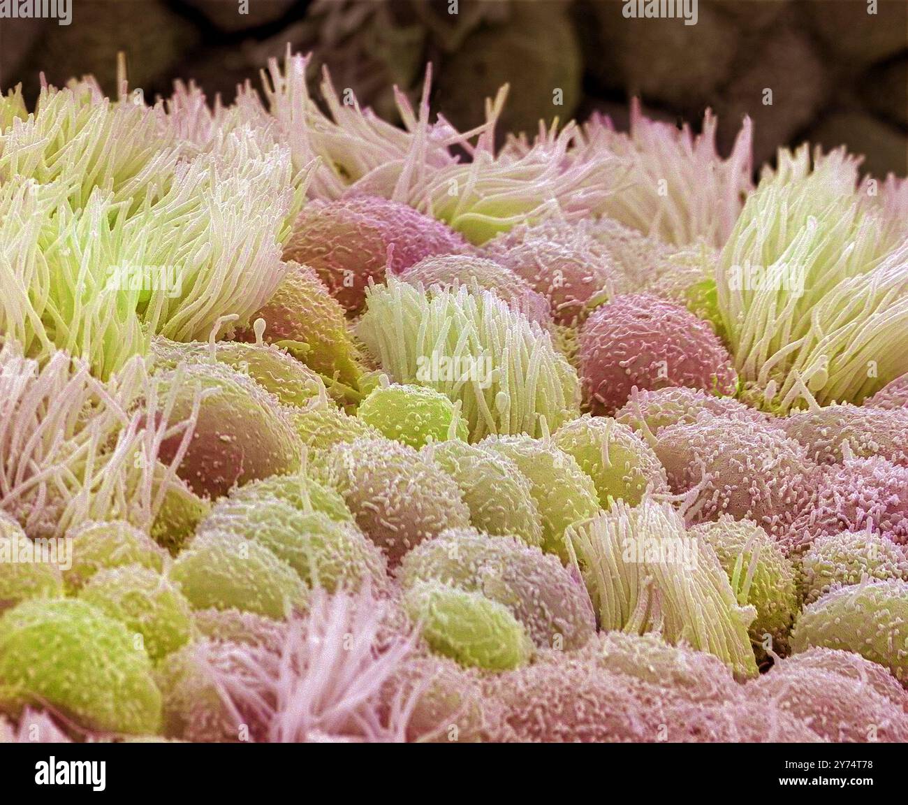 Uterus scanning electron micrograph hi-res stock photography and images ...