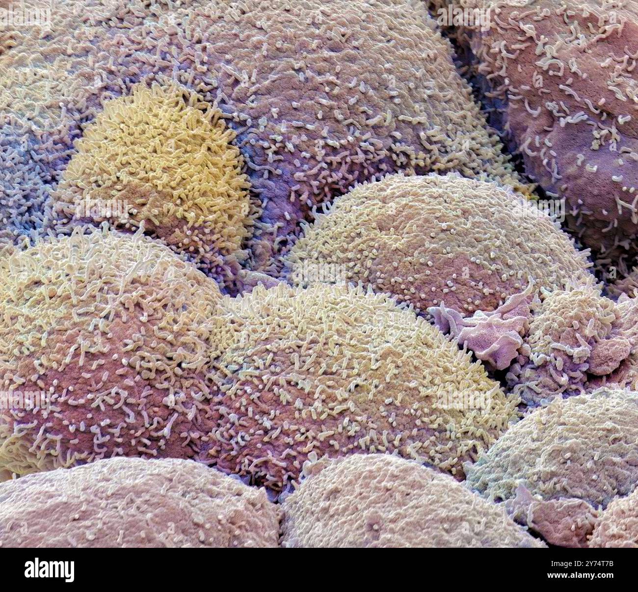 Human prostate, coloured scanning electron micrograph (SEM). The ...