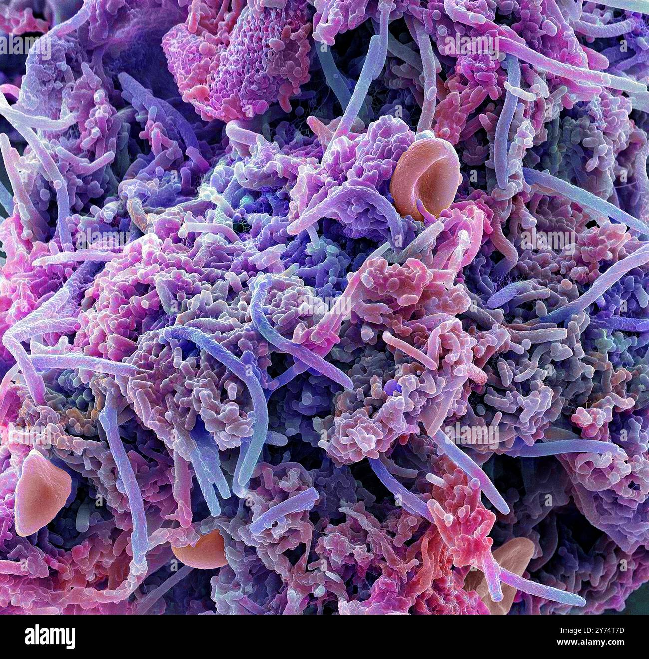 Plaque-forming bacteria, coloured scanning electron micrograph (SEM ...