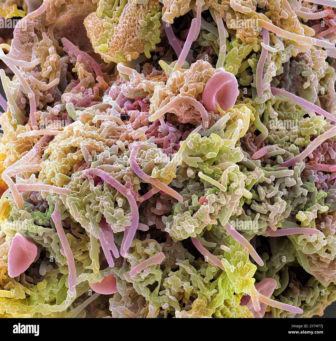 Plaque-forming bacteria, coloured scanning electron micrograph (SEM ...