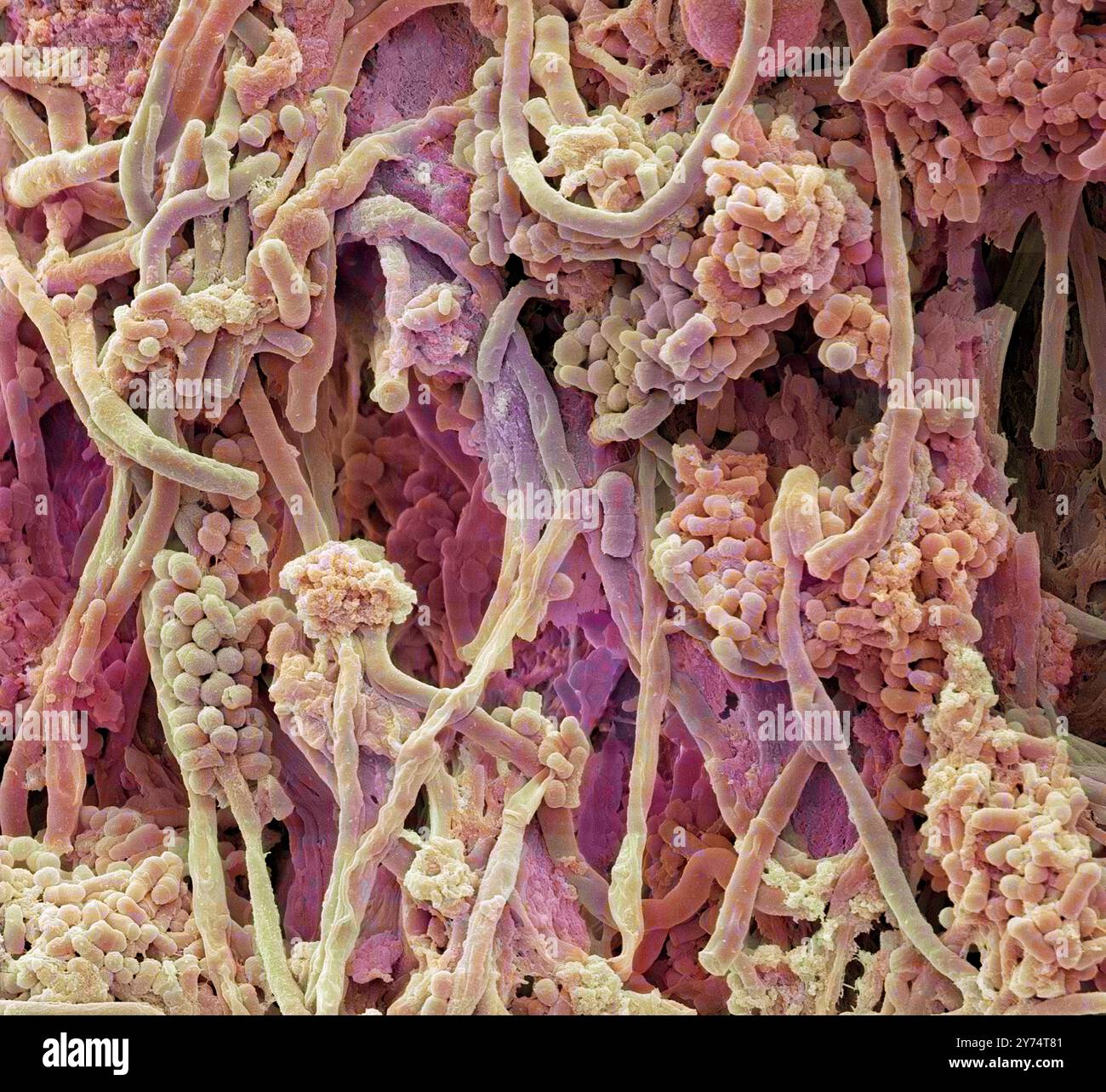 Plaque-forming bacteria, coloured scanning electron micrograph (SEM ...