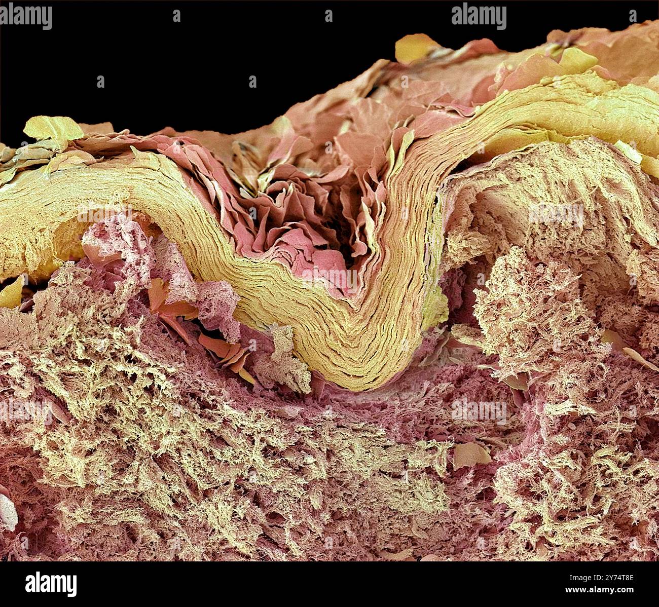 Layers of skin sem hi-res stock photography and images - Alamy