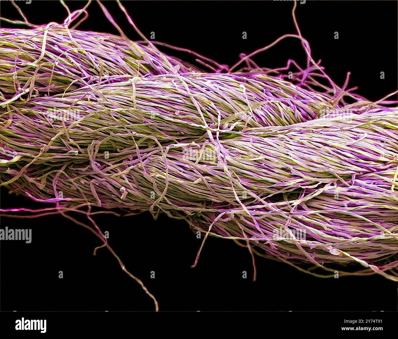 Viscose fibres from a tampon. Scanning electron micrograph of highly ...