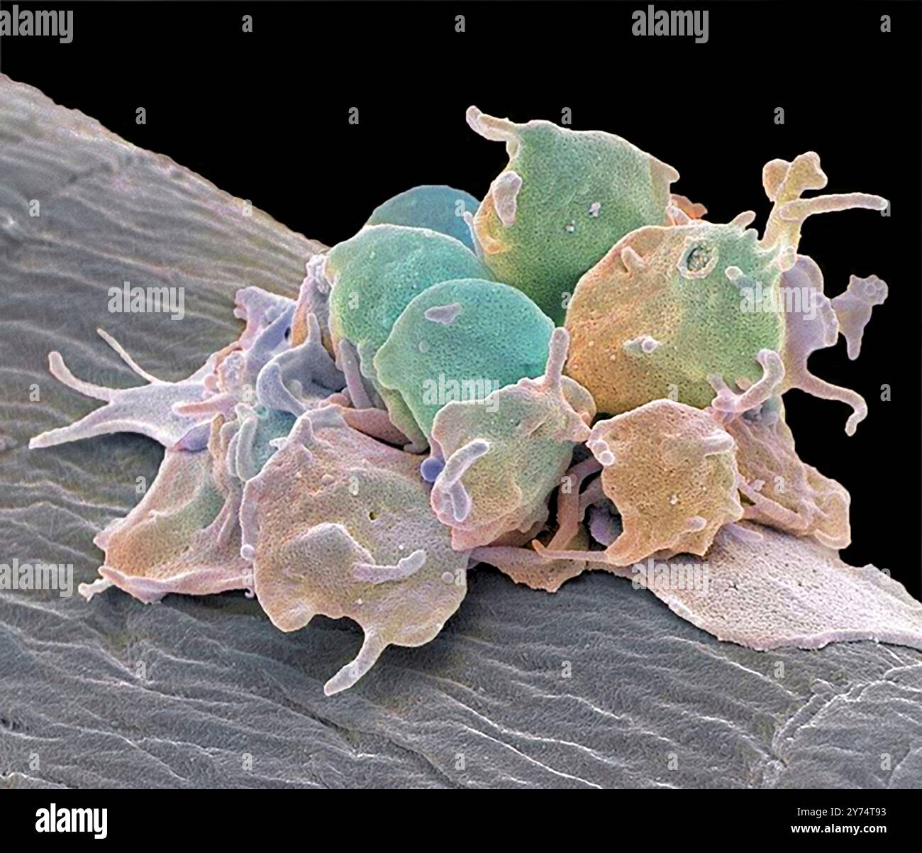 Activated platelets growing on a filter, coloured scanning electron ... Activated platelets growing on a filter, coloured scanning electron ...
