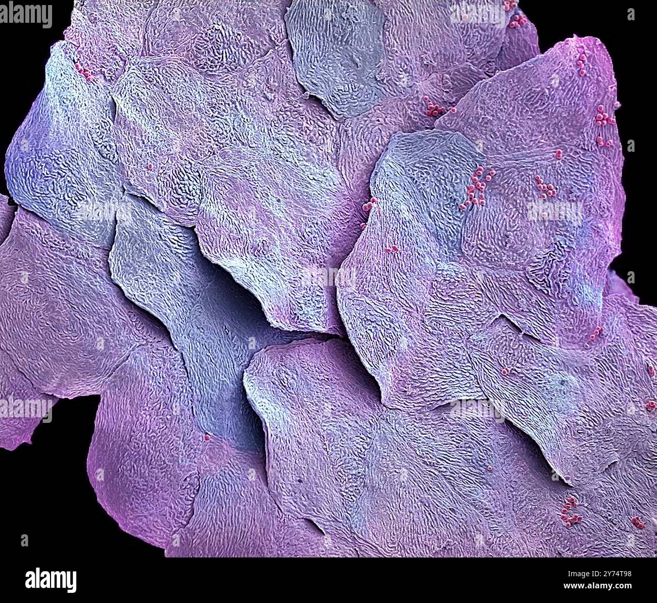 Skin cells, SEM Stock Photo - Alamy