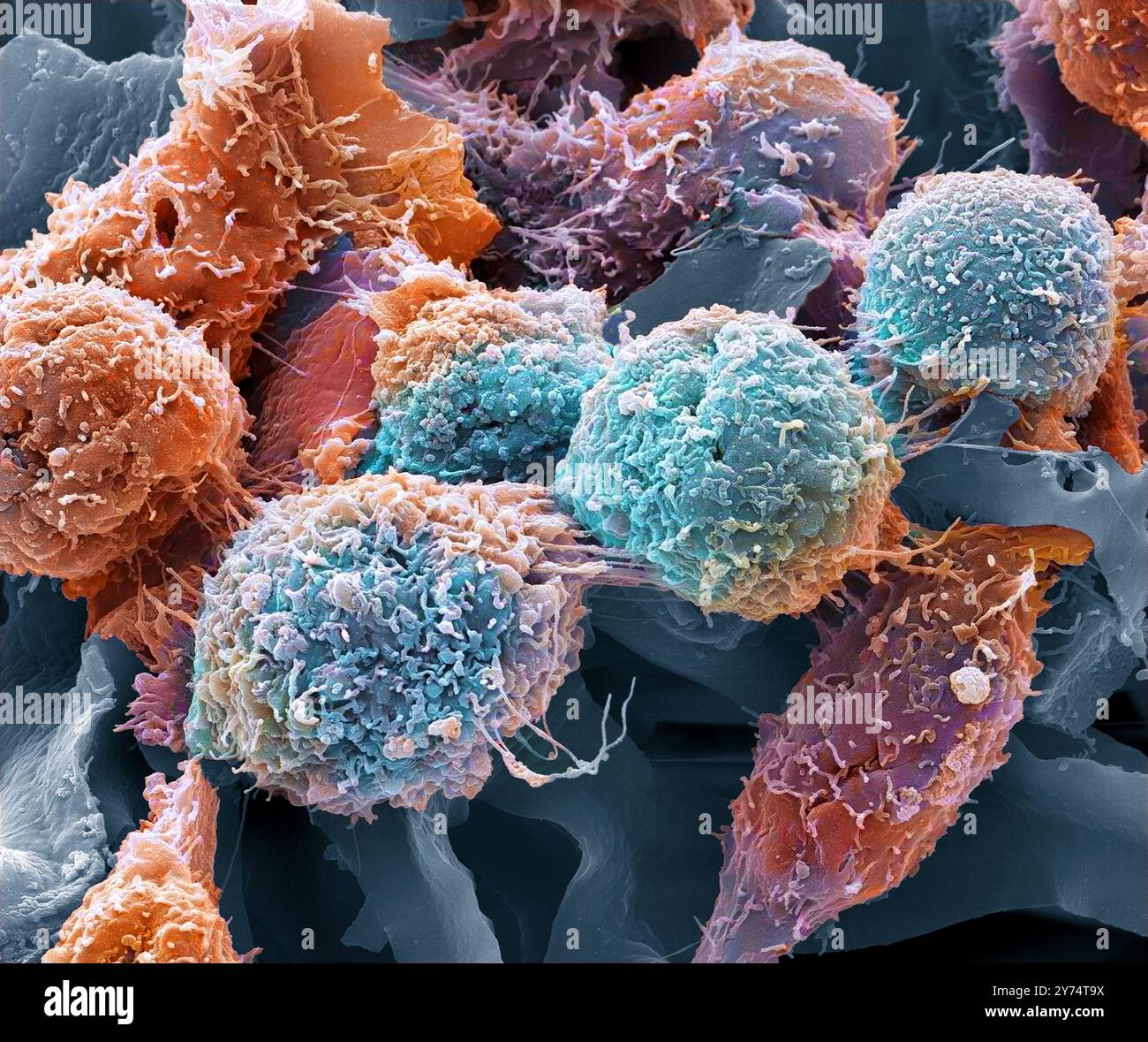 HeLa cells, SEM Stock Photo - Alamy