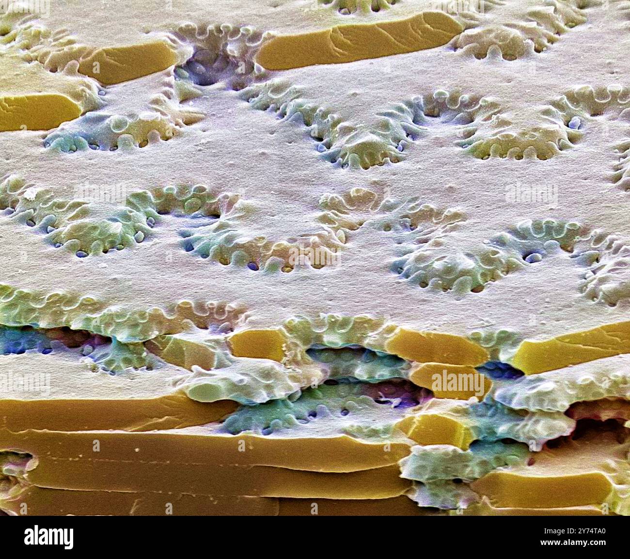 Eye lens fibres. Coloured scanning electron micrograph (SEM) of a ...