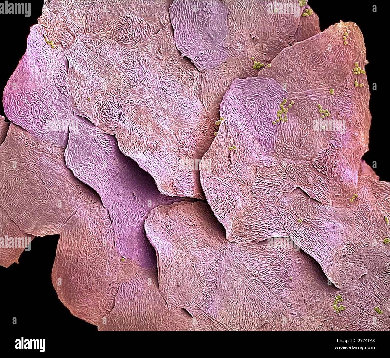 Skin cells, SEM Stock Photo - Alamy