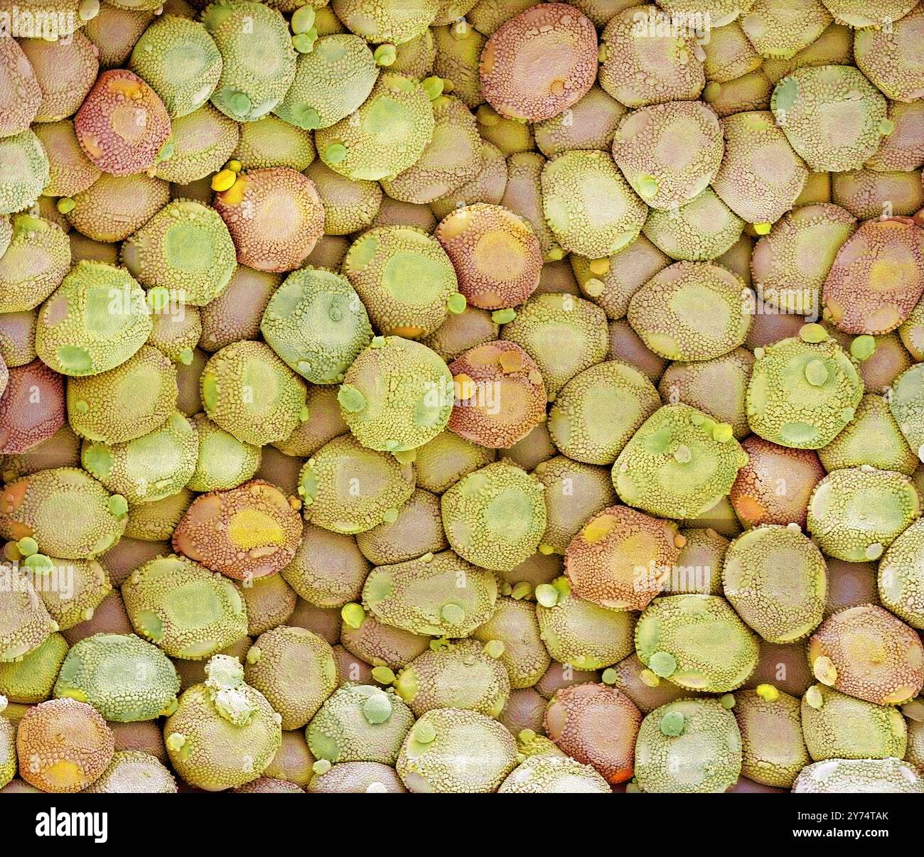 Rust fungus infection. Coloured scanning electron micrograph (SEM) of ...
