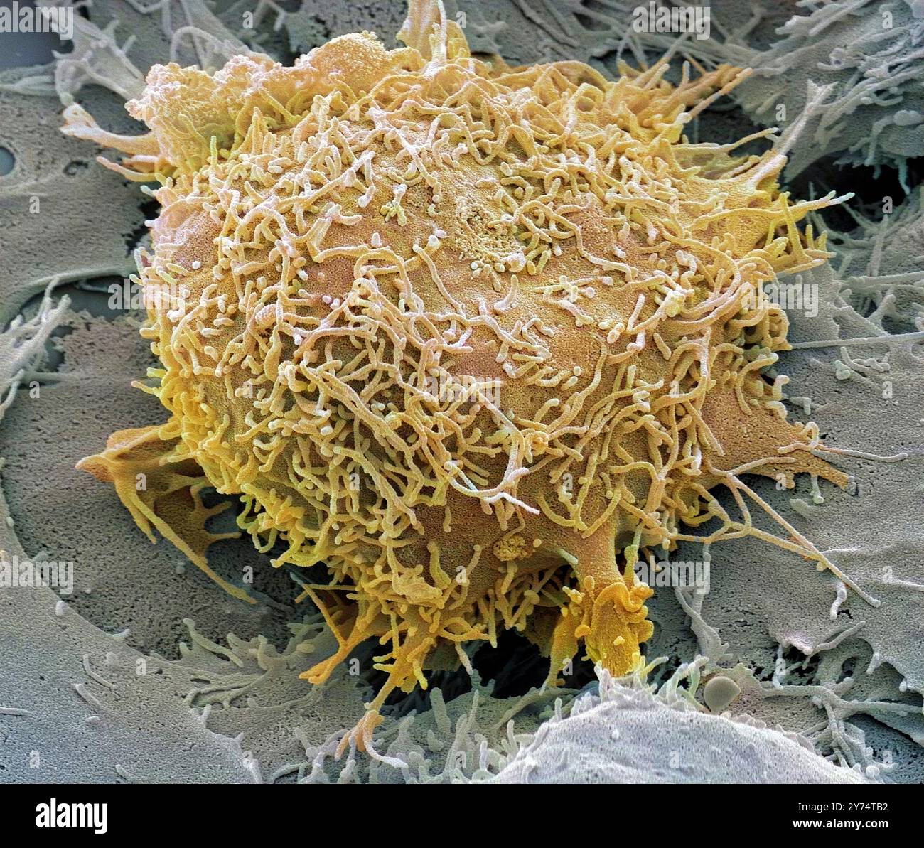 Liver cell sem hi-res stock photography and images - Alamy