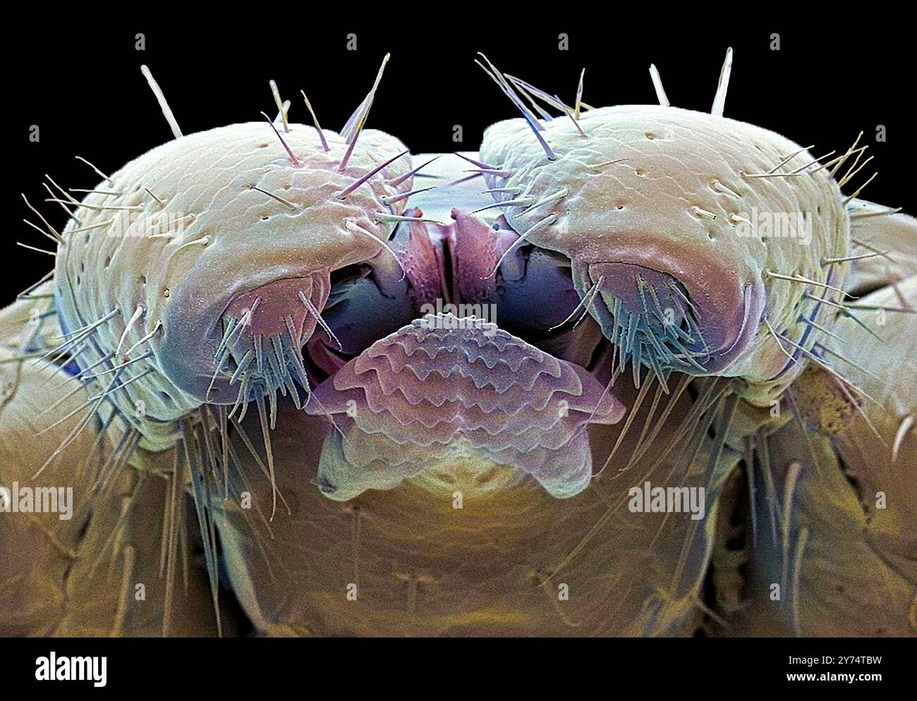 Lyme disease tick, SEM Stock Photo - Alamy