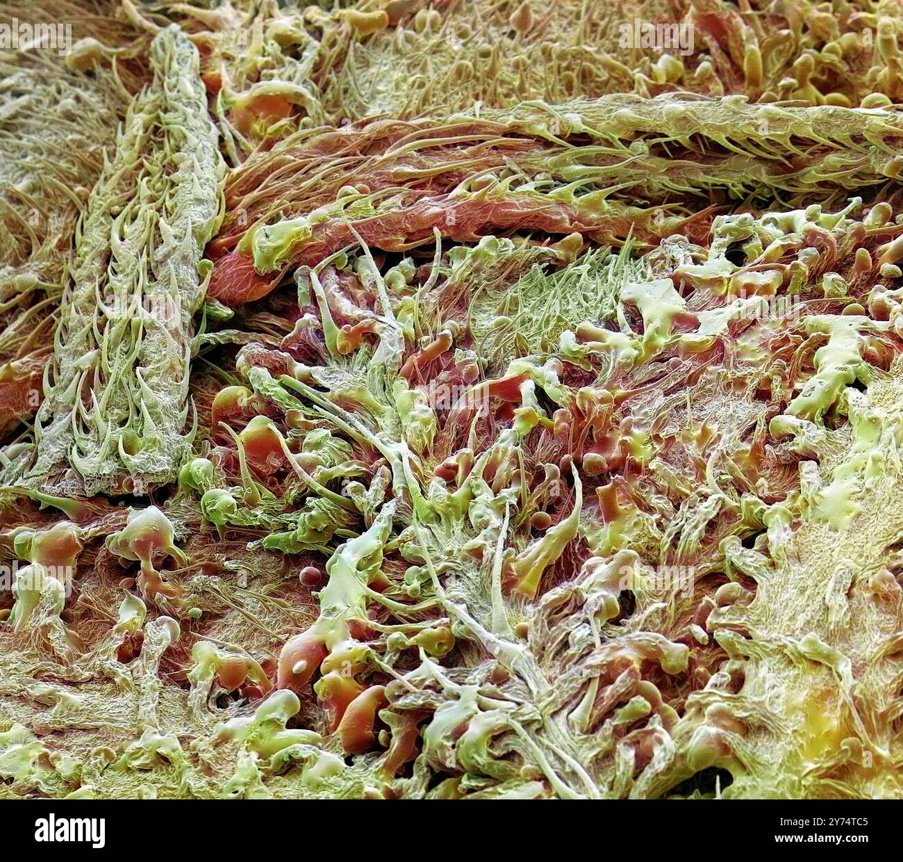 Cannabis plant. Coloured scanning electron micrograph (SEM) of the ...