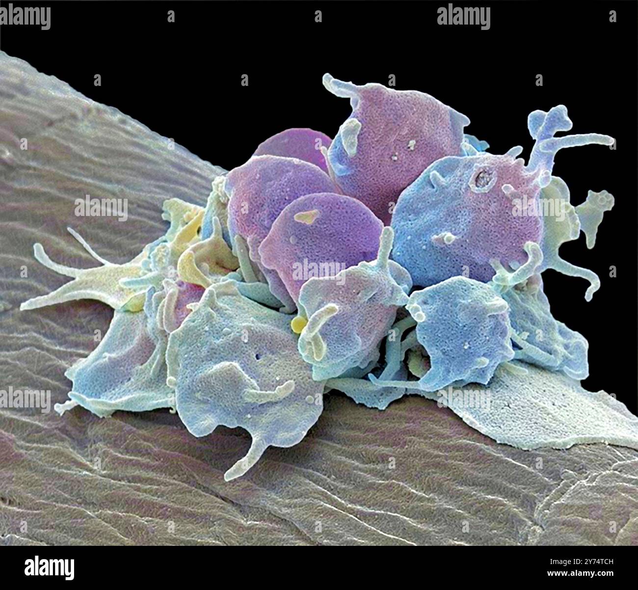 Activated platelets, SEM Stock Photo - Alamy