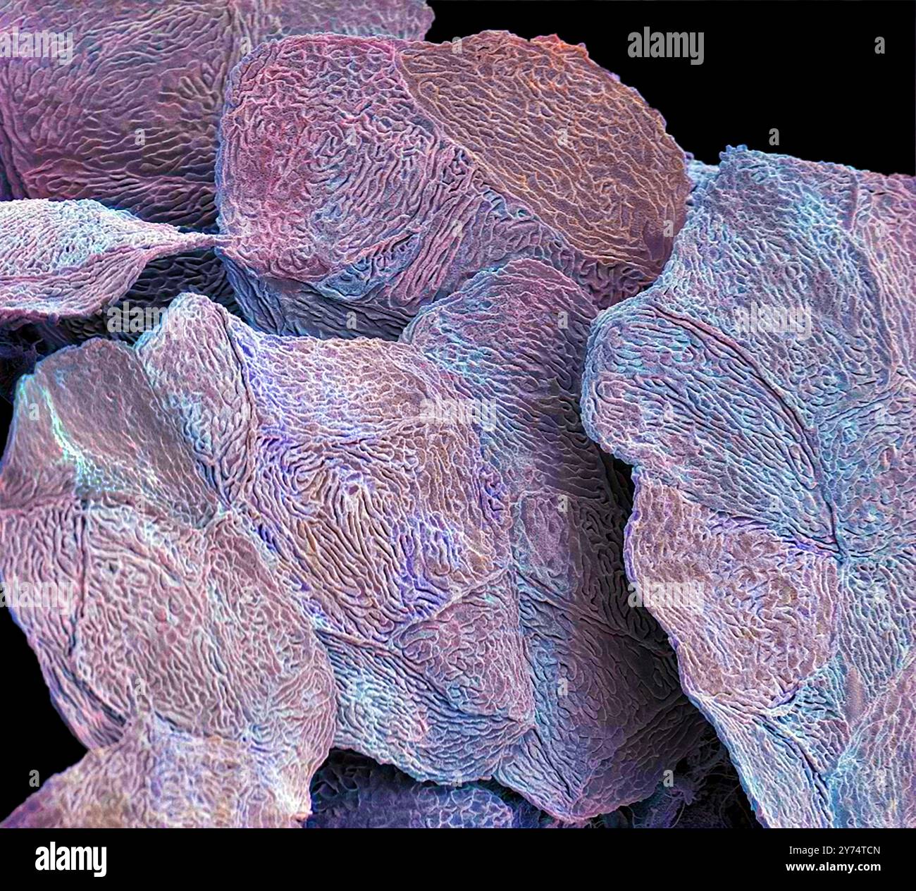 Skin cells. Coloured scanning electron micrograph (SEM) of squamous ...