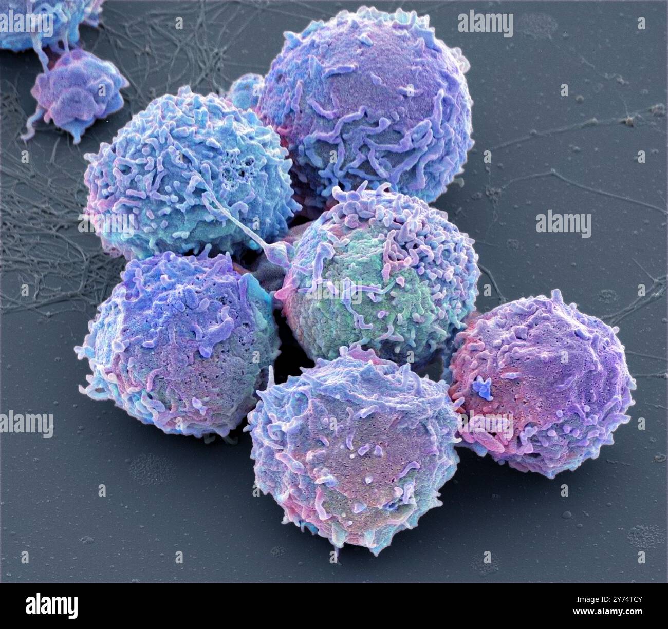 White blood cells. Coloured scanning electron micrograph (SEM) of human ...