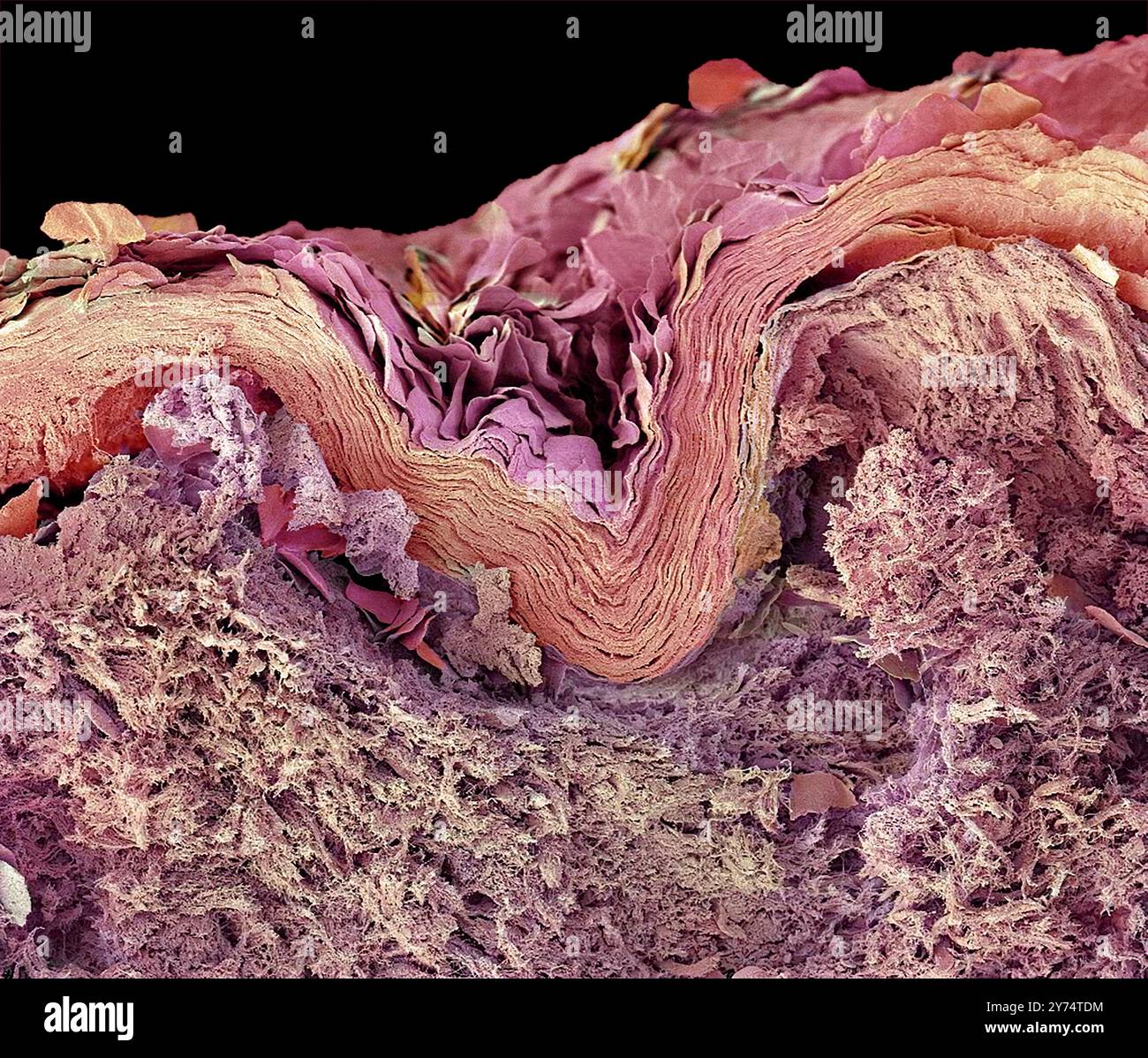 Dermis sem hi-res stock photography and images - Alamy