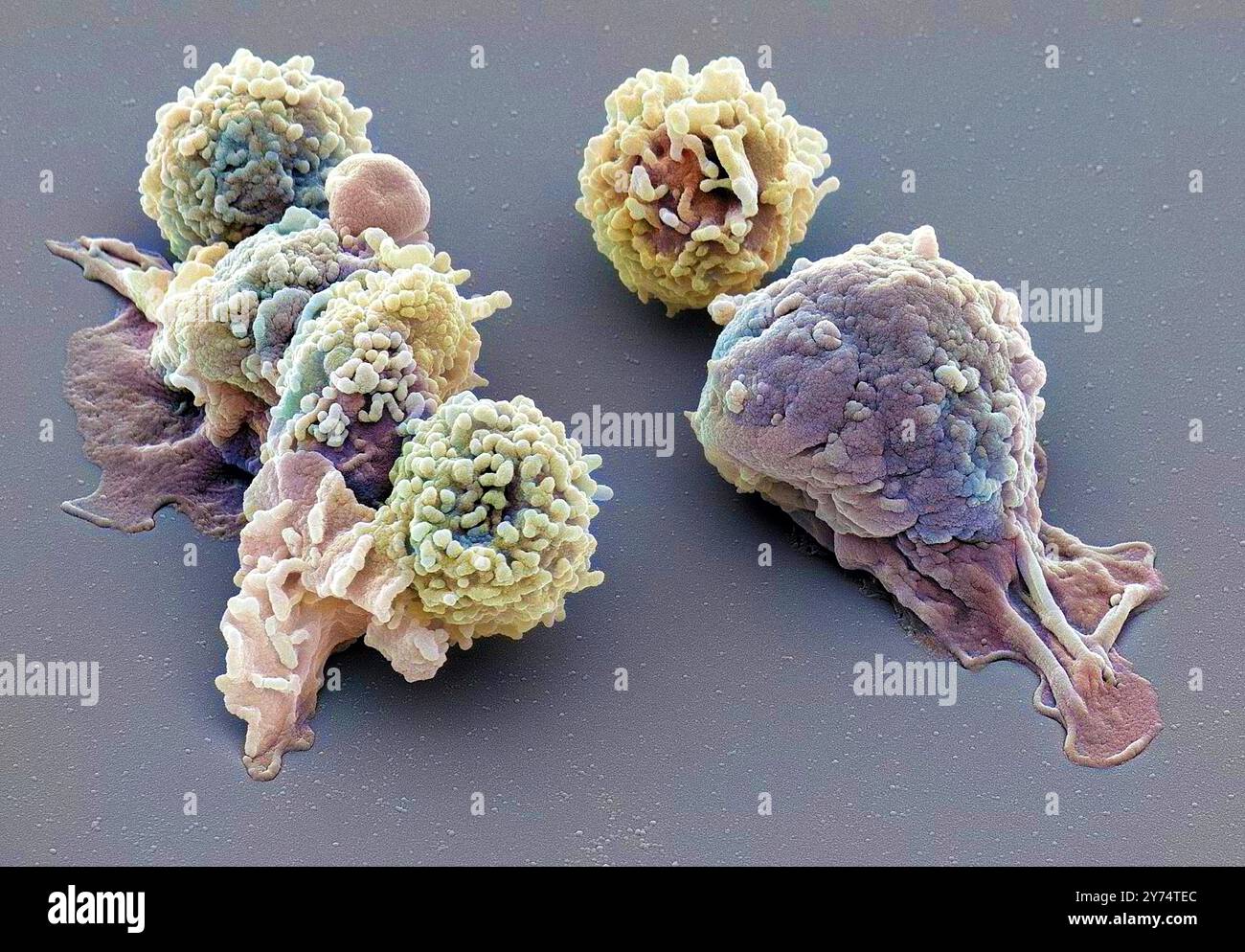 Granulocytes. Coloured scanning electron micrograph (SEM) of ...