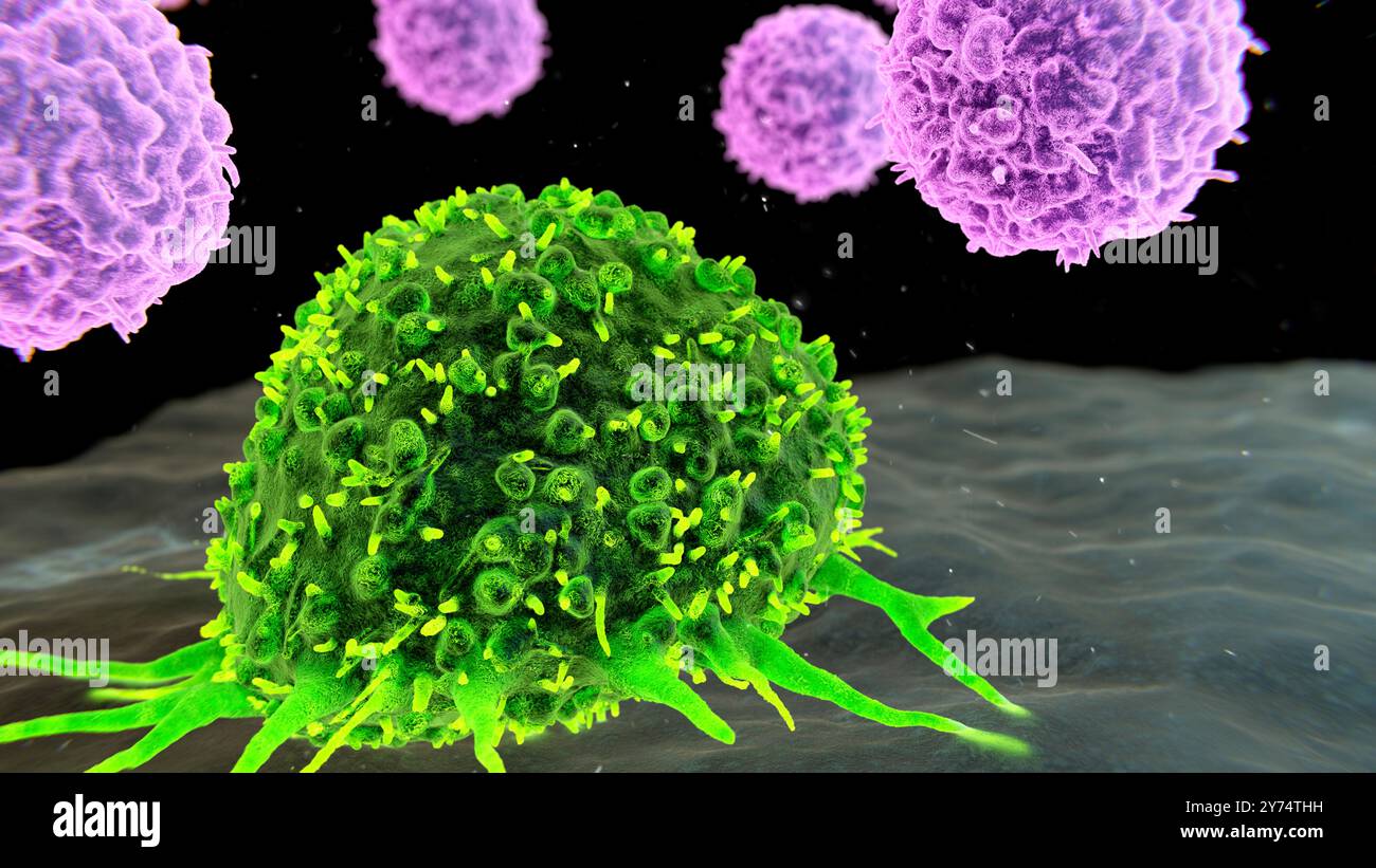 Illustration depicting tumour infiltrating lymphocyte (TIL) therapy, a ...