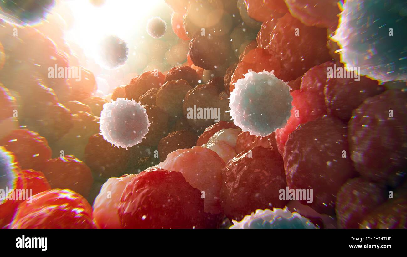 Illustration depicting tumour infiltrating lymphocyte (TIL) therapy for ...