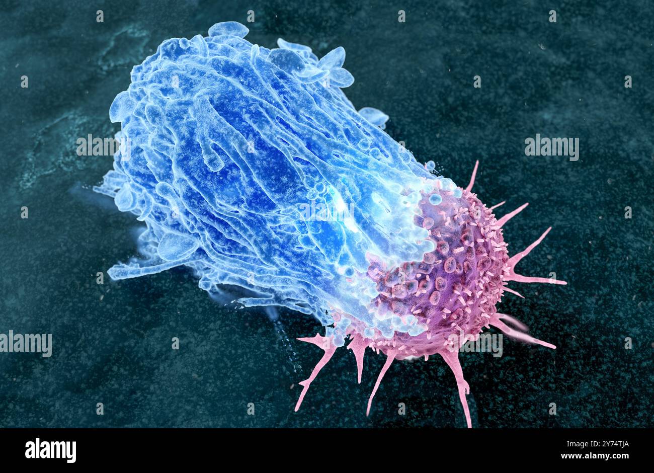 Illustration of a human macrophage cell attacking a cancer cell Stock ...