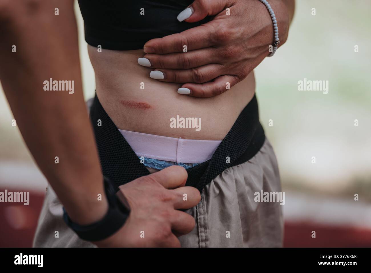Abdomen bruise hi-res stock photography and images - Alamy
