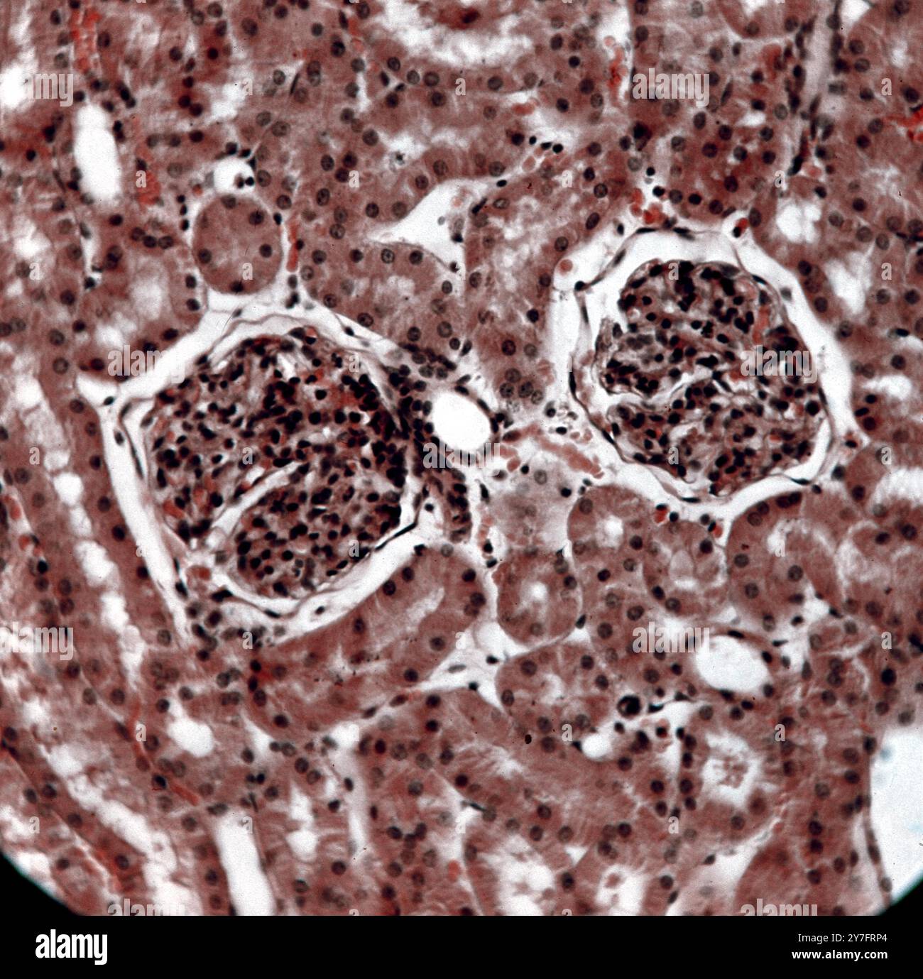 Human Kidney Section showing Glomeruli Stock Photo - Alamy