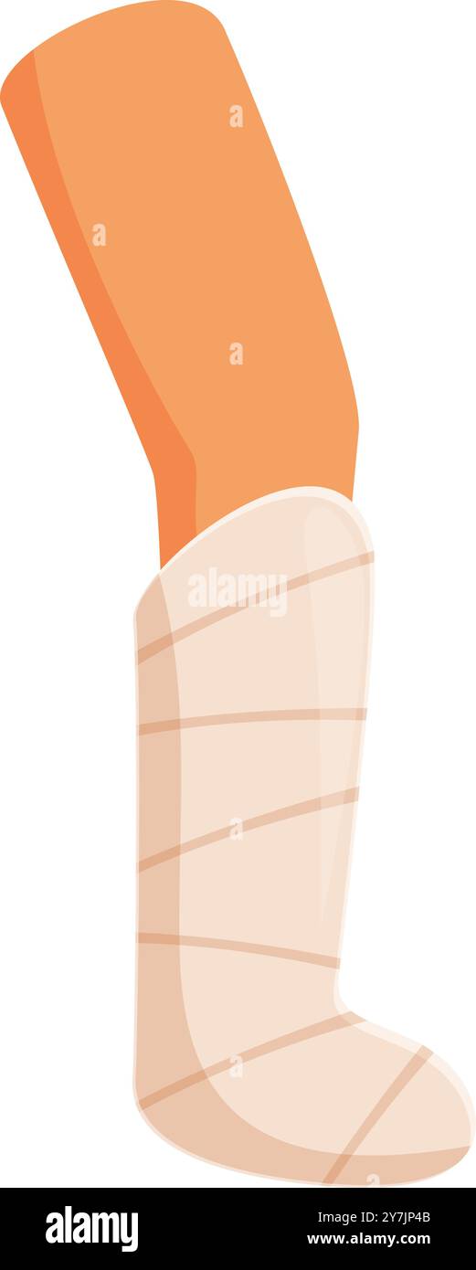 Leg with plaster being treated after injury, isolated on white ...