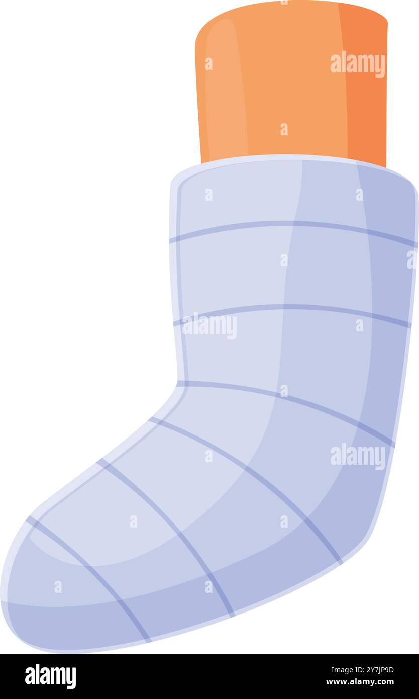 Blue plaster cast is covering injured leg after fracture, providing ...