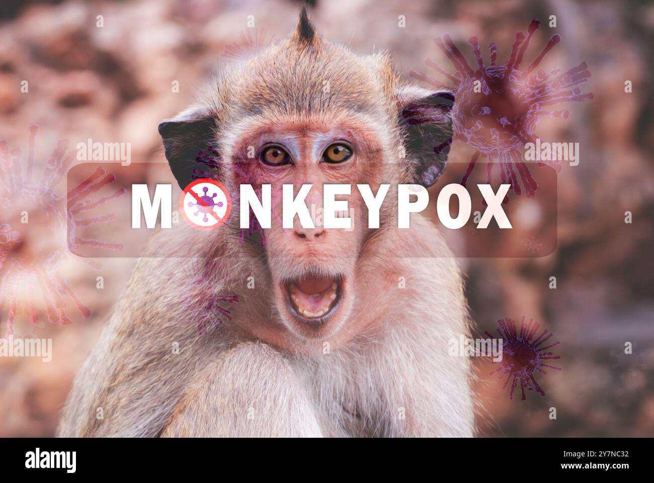 Mpox caused by monkeypox virus. Monkeypox outbreak. Viral transmission ...