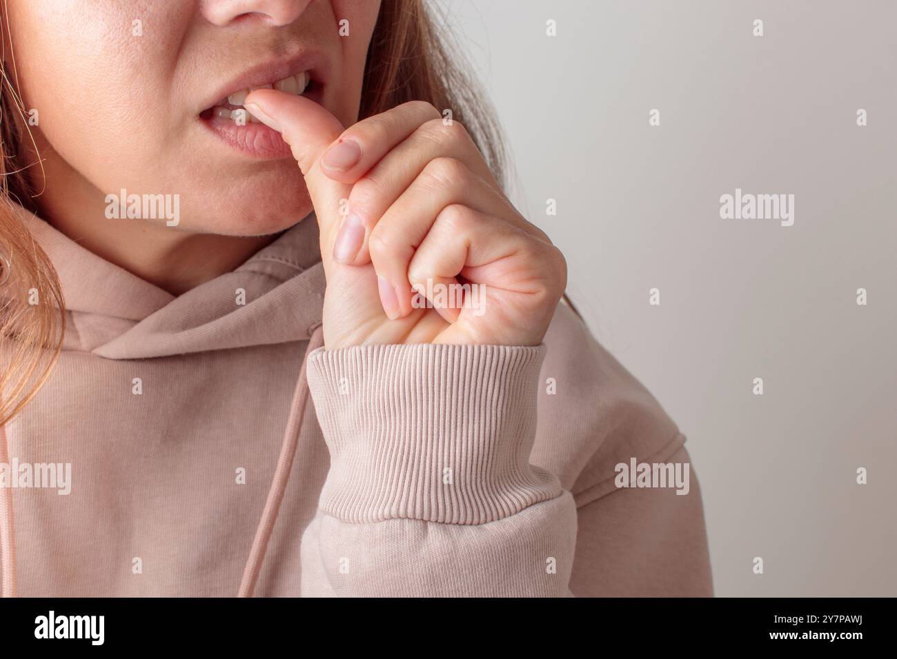 Onychophagy. A nervous young woman is biting her nail due to stress and ...
