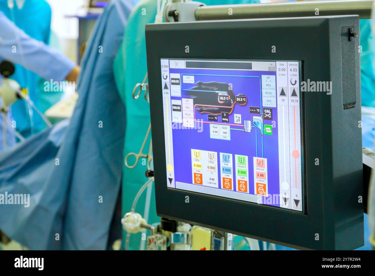 Artificial blood circulation apparatus in intensive care during heart ...