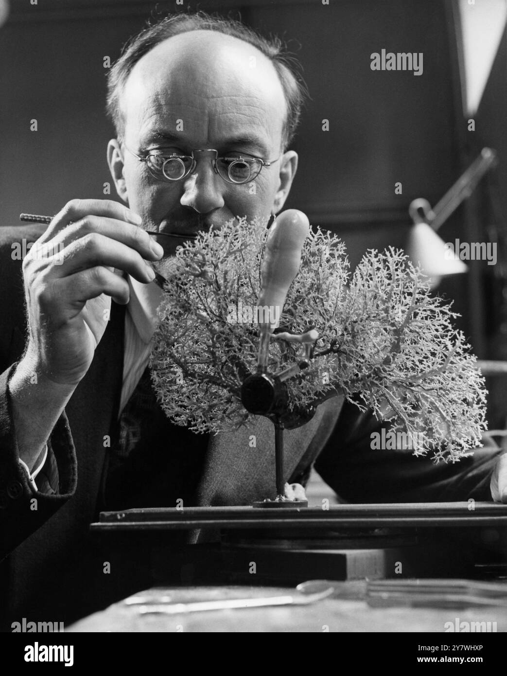 Putting the finishing touches to a corrosion cast of the human liver ...