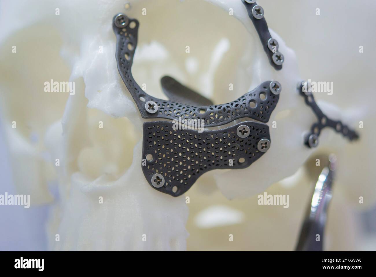 Prototype of human skull from white plastic with titanium implants in ...