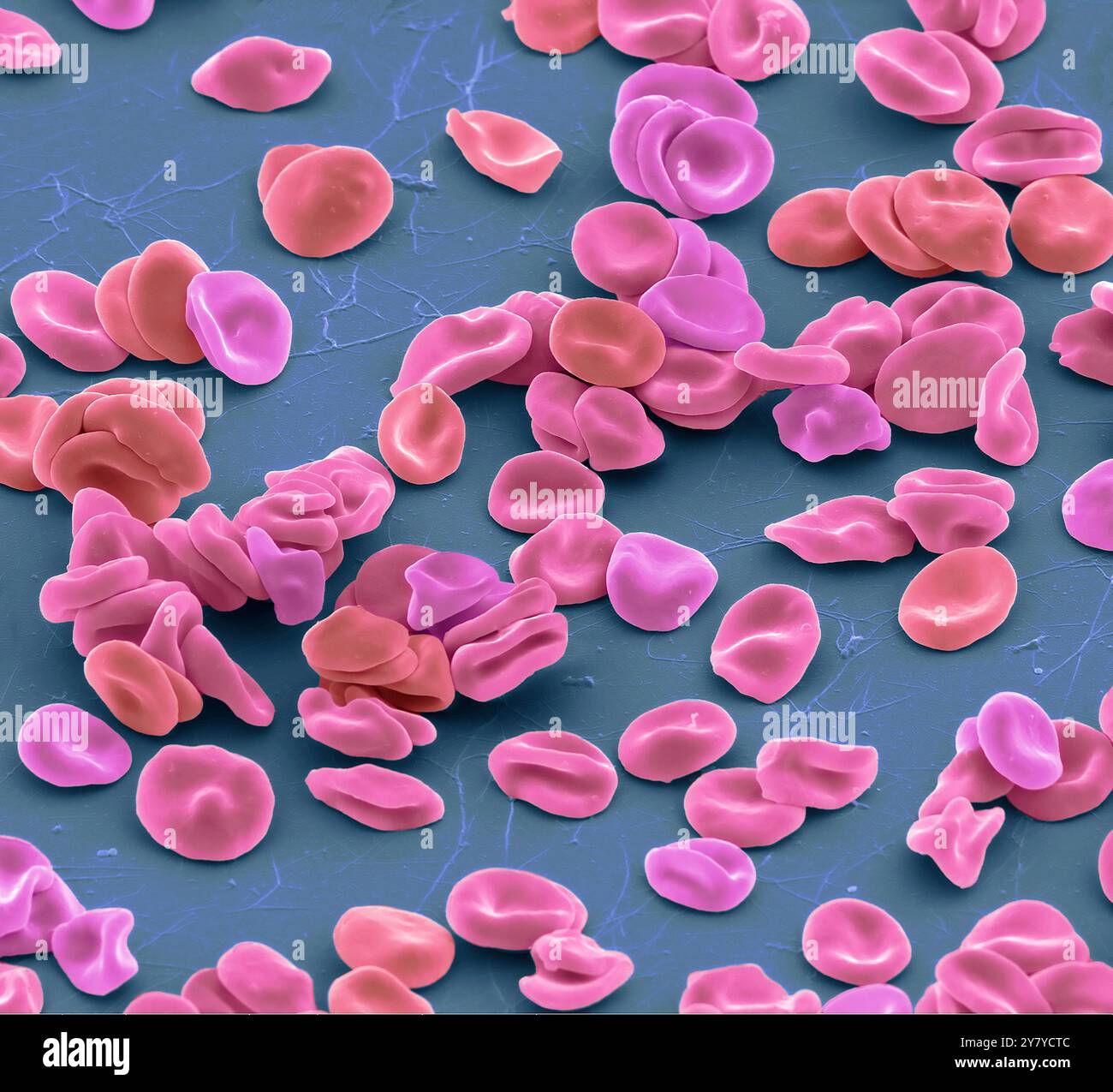 Red blood cells. Coloured scanning electron micrograph (SEM) of red ...