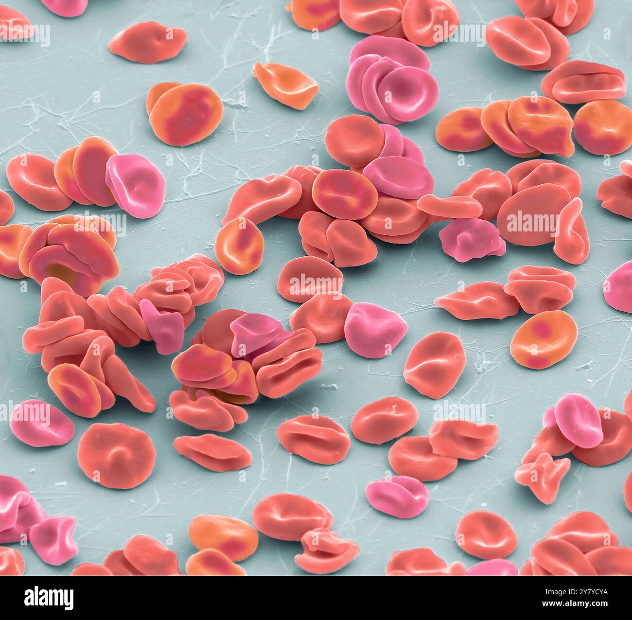 Red blood cells. Coloured scanning electron micrograph (SEM) of red ...